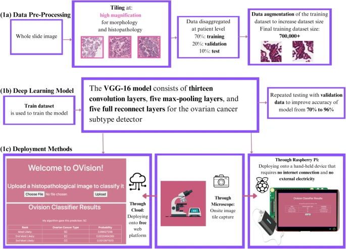 OVision A raspberry Pi powered portable low cost medical device ...